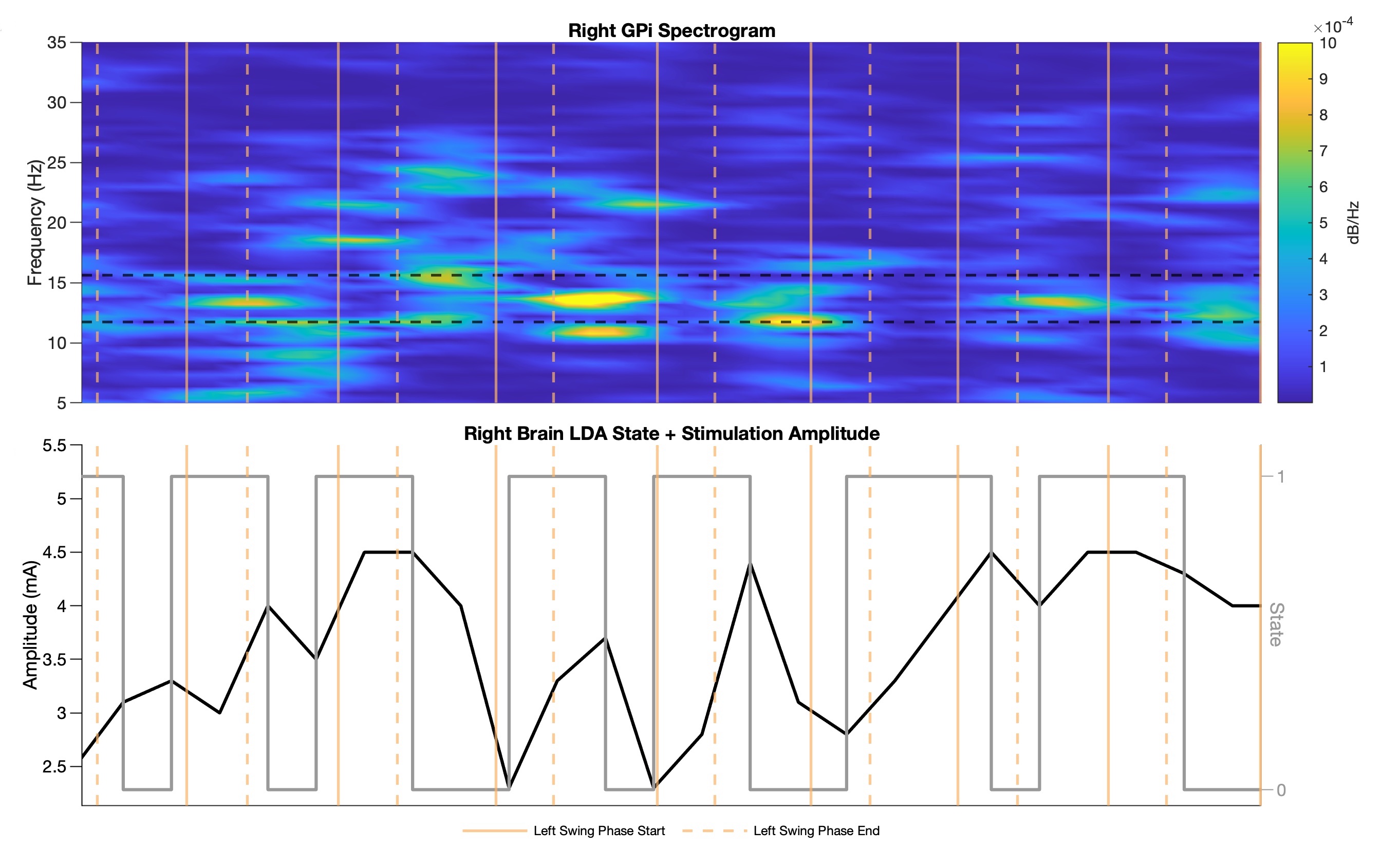 Adaptive Deep Brain Stimulation | Wang Lab | Unraveling circuit ... Adaptive Deep Brain Stimulation | Wang Lab | Unraveling circuit ...